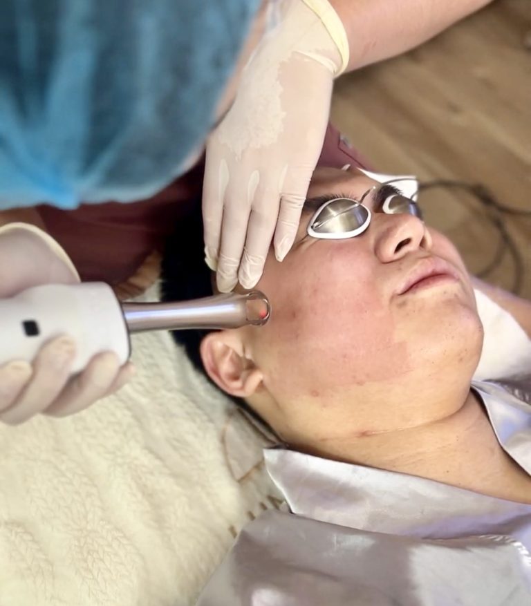From Scars to Confidence: How Luminisce UltraClear 3D Miracle Laser ...